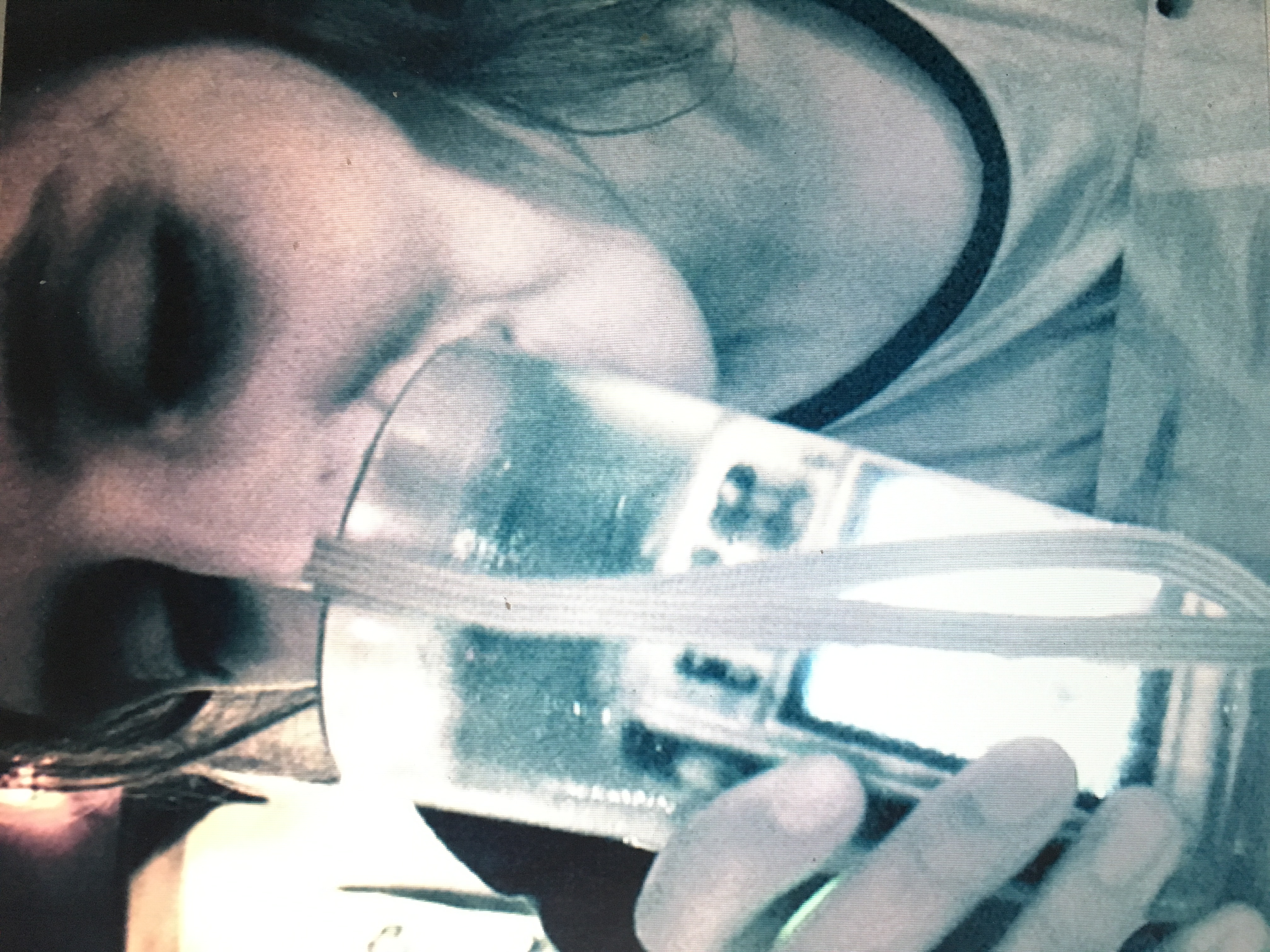 image – Emily Wick